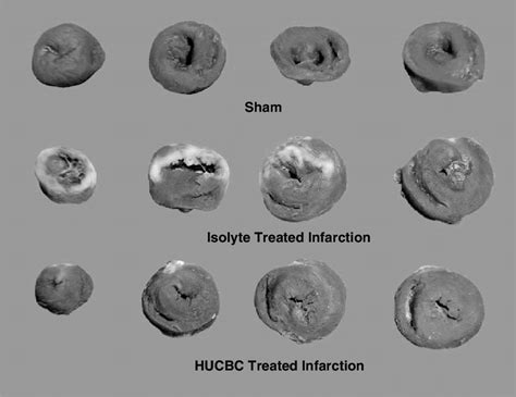 Representative Tetrazolium Stained Hearts From A Sham Control Heart An