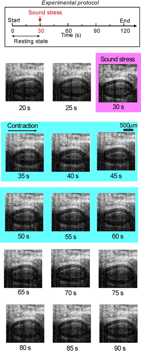 Figure 6 From Dynamic Analysis Of Mental Sweating Of The Sweat Glands And Peripheral Vessels By