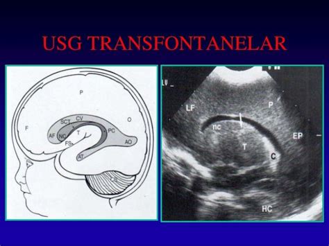 Ultrasonido Transfontanelar Ultrasonido Ciclo Ovarico Ecografía