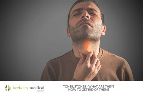 Tonsil Stones What They Are And How To Get Rid Of Them Medical Centre Berkeley Medical