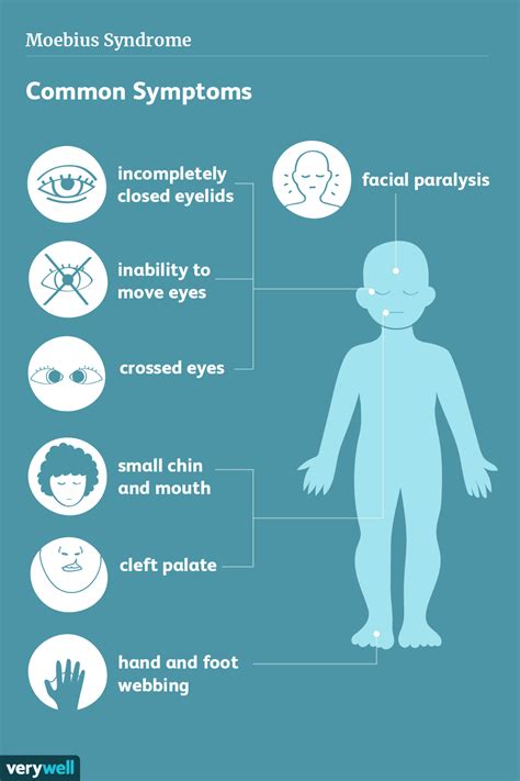 Is Moebius Syndrome A Diity