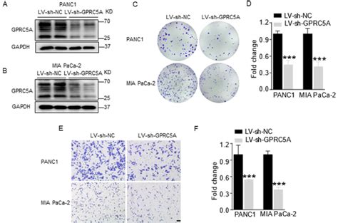 Knockdown Of Gprc5a Inhibits Cell Proliferation And Migration Of