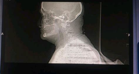 Ehsan Saadat Nia Posted On Linkedin