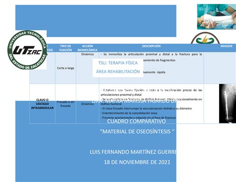 Tipo De Osteosíntesis Tipos De Osteosintesis Universidad
