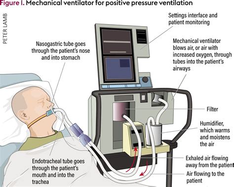 Ventilator Oxygen Sensor At Tara Bradford Blog