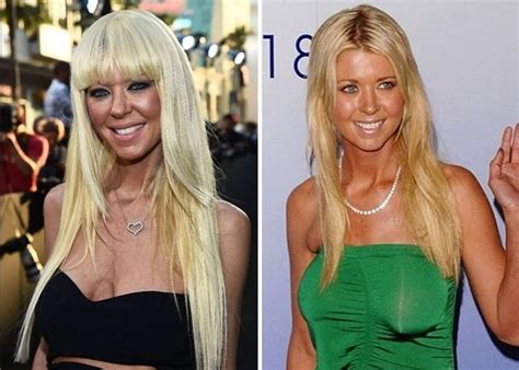 Tara Reid Avant Et Après