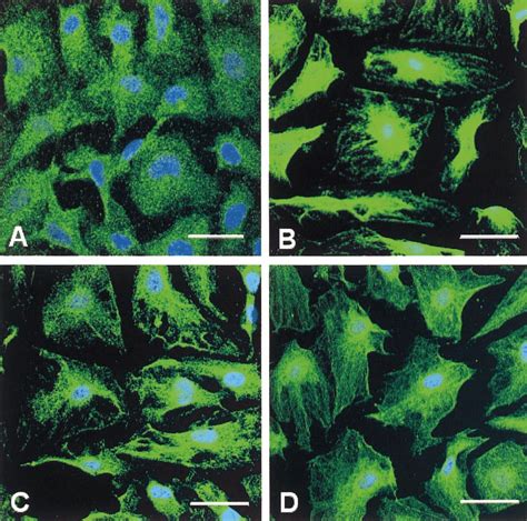 Mt Localization In Huvec After Treatment With Glucose In Combination Download Scientific