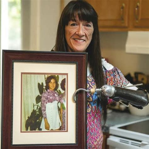 Mary Mcgriff Vincents Story Her Hands Were Cut Off And She Was Left