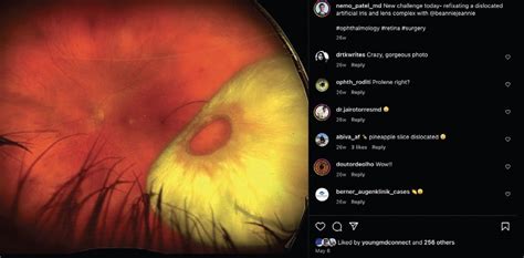 Social Media And Retina Retina Today