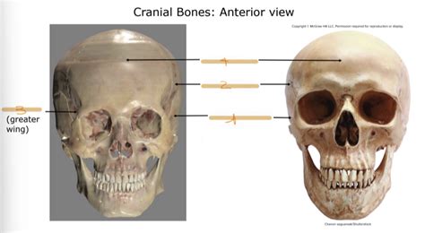 Skull Diagram Quizlet