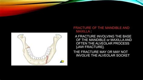 Classification Of Traumatic Injuries To Anterior Teeth Andreasens