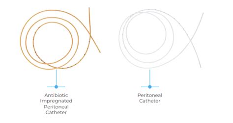 Ventricular Catheter Kit Desu Medical