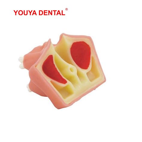 Dental Model Teeth Implant Practice Model Maxillar Grandado