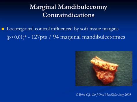Ppt Evidence Based Management Gingivo Buccal Cancer Powerpoint