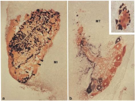 A B Double Staining By Sequential Use Of Immunogold Silver Staining