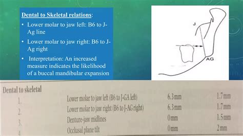 Pa Ceph Analysis Pptx