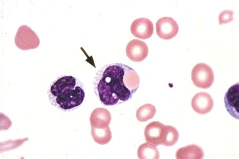 Hematology Ch 7 Flashcards Quizlet Hematology Ch 7 Flashcards Quizlet