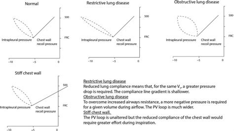 Respiratory Pressure Volume Loops Springerlink