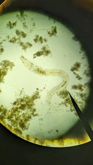 Proteus Mirabilis Swarm That I Thought Looked Neat From Todays Urine Cultures Rmicrobiology