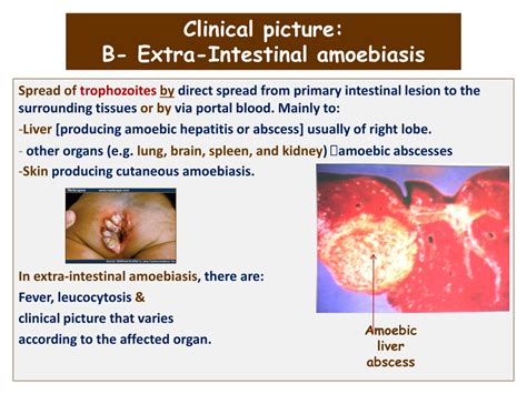 Ppt Medical Parasitology A Comprehensive Overview Powerpoint