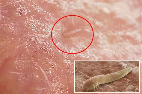 These Nipple Mites Have Sex On Your Face As You Sleep