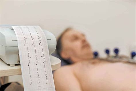 Angiogram Thru Wrist Step By Step Guide Liv Hospital