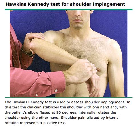 Hawkins Kennedy Test