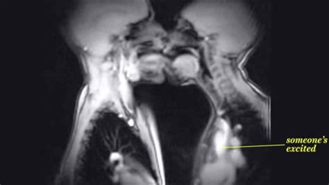 Mri Scanner Footage Shows What Sex Looks Like From The Inside Daily