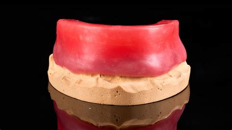 Bite Block What You Need To Know Xdent Lab