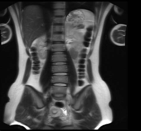 Mri Localizer Scout Or Survey Scan T1 T2 And 3d Localizers