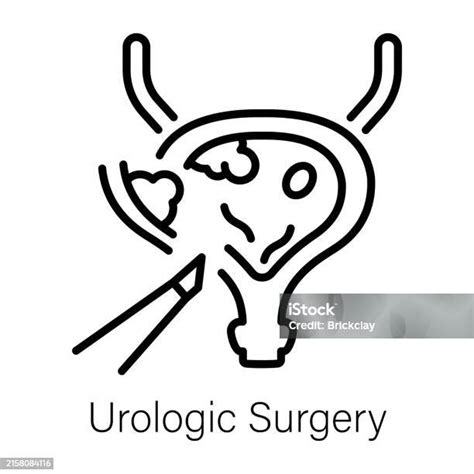 Urologic Surgery Stock Illustration Download Image Now Healthcare