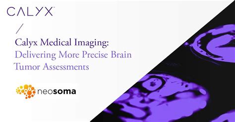 Siddam Sravani On Linkedin Medicalimaging Neurooncology
