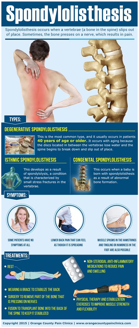 Spondylolisthesis Orange County Pain Clinics