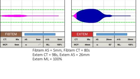 Rotem Flip Cards Test Your Interpretation Skills Obsgynaecritcare