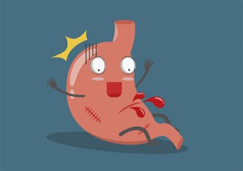 Upper Gi Bleed Ugi Bleed Scoring Mnemonics Epomedicine