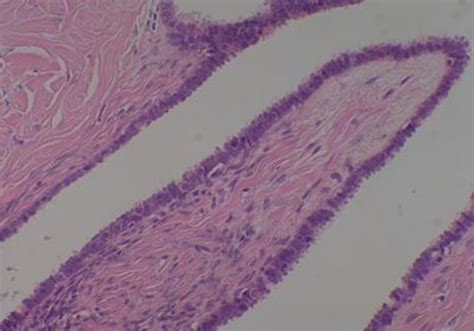 Novus Biologicals™ Human Ovary Tissue Microarray Cancer Slide Human