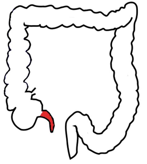 Usus Buntu Apa Perannya