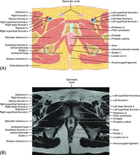 Ab The Normal Male Anatomy Of The Perineum At The Level Of The Mid