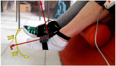 Smart Protocols For Physical Therapy Of Foot Drop Based On Functional