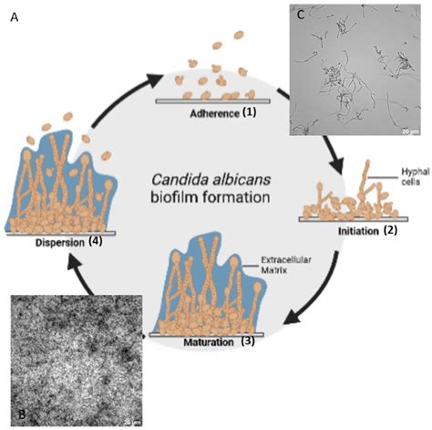Candida Albicans Yeast