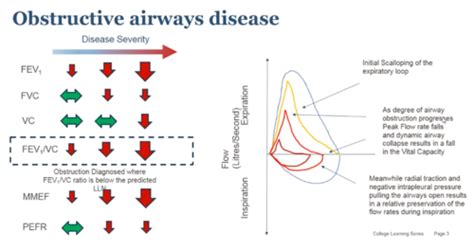 Spirometry Lung Function And Ild Flashcards Quizlet