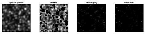 Filters Speckle Pattern Speckles Detection Signal Processing