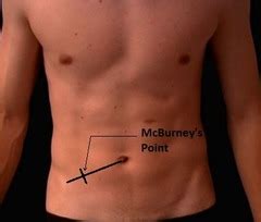 Surgery 2 Signs And Triads P3 4 Flashcards Quizlet