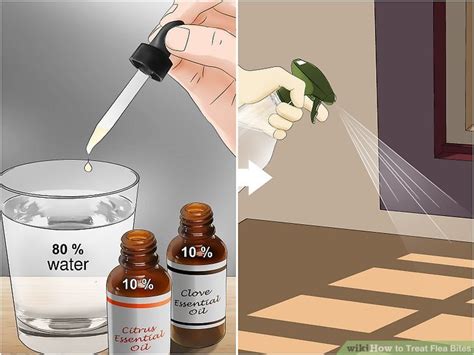 3 Ways To Treat Flea Bites Wikihow