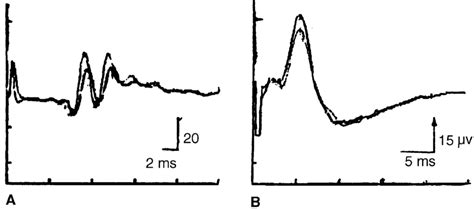 A Near Field Response Recorded At The Trigeminal Root B Far Field Tep Download Scientific
