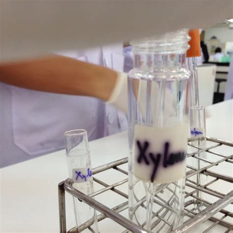 Today We Have Red Cell Elution Department Of Medical Technology