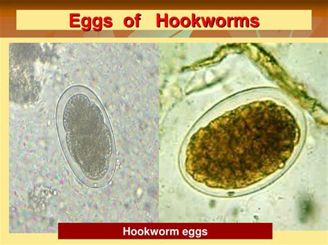 Ppt Nematodes 2 Powerpoint Presentation Free Download Id4923754
