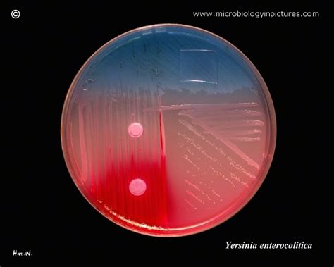Xld Agar Yersinia Entercolitica