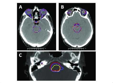 Ct Axial Scans Showing Examples Of The Predicted Ct Deep Learning Download Scientific Diagram