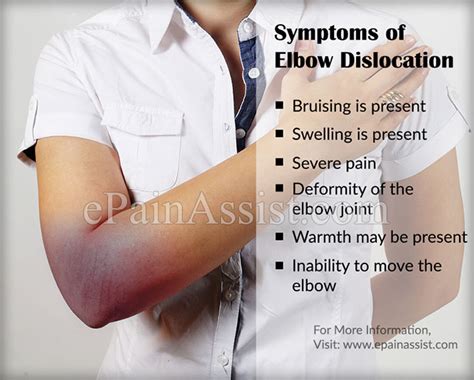 Elbow Dislocation Hand Swelling At Jackson Nicolle Blog